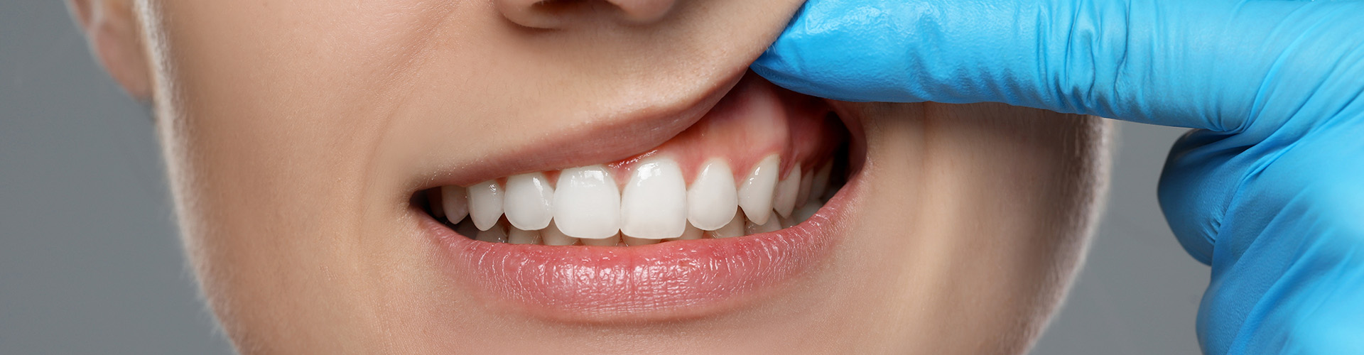 Gum Disease: Causes, Symptoms, and Treatment | Nu Dentistry Houston